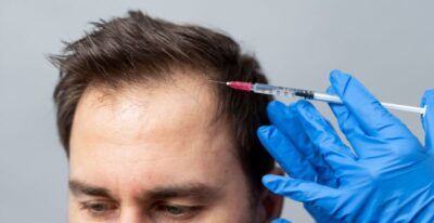 PRP Vs GFC: Dermatologist Comparison - Anceita Clinic