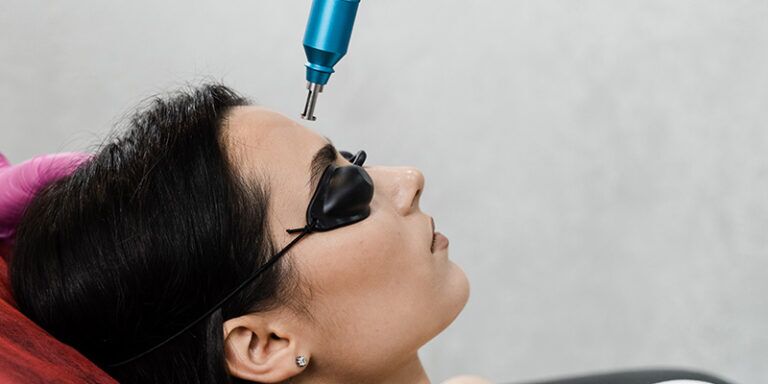 Laser Skin Resurfacing Treatment: Cost, Benefits And Procedure