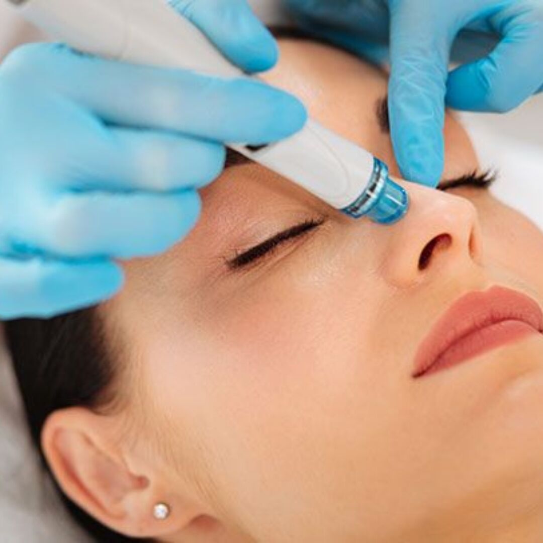 Original HydraFacial MD: Oily, Dry, Dehydrated Skin Solution